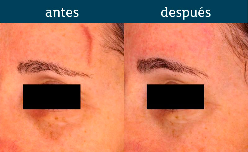 Galería Antes Y Después Cde De Alicante 965 140 460